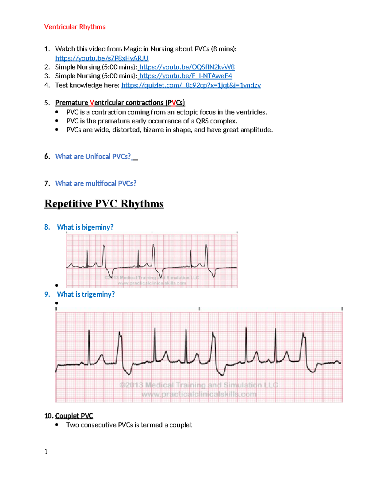 5. Ventricular Rhythms student - Watch this video from Magic in Nursing ...