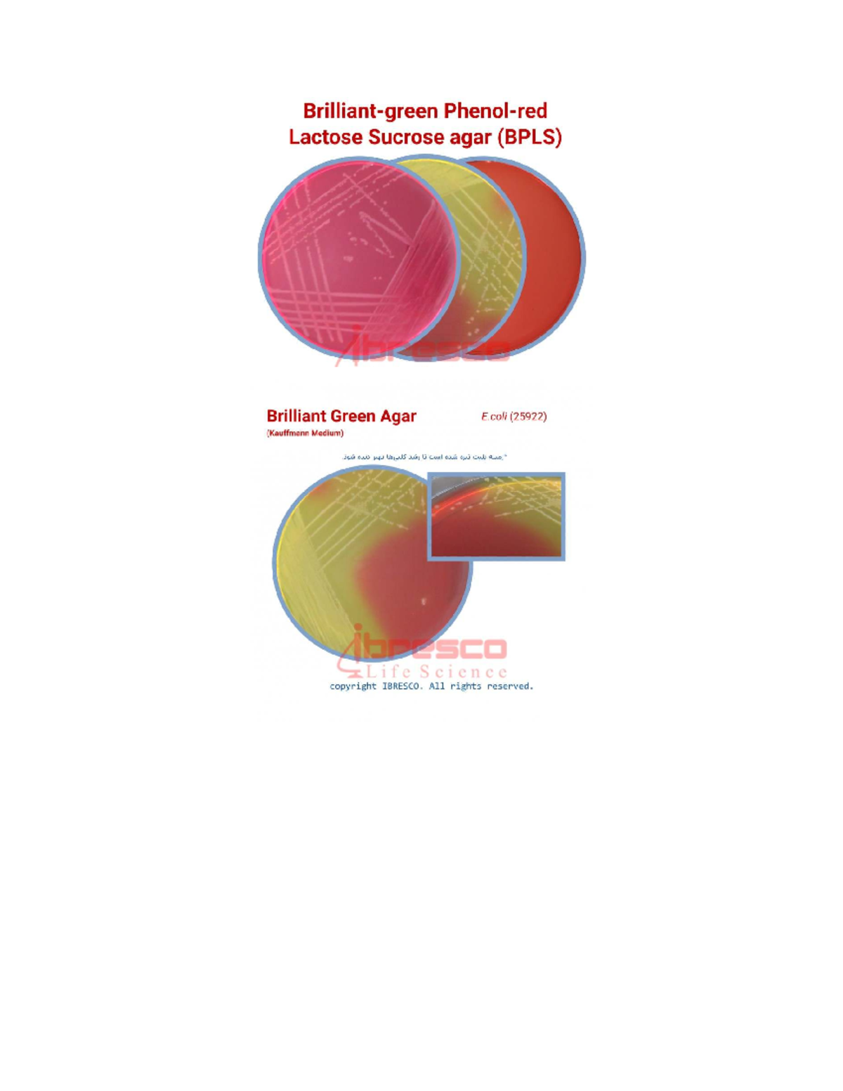 Agar verde brillante - Microbiología General - Lactose Sucrose agar (BPLS) Brilliant Green Agar ...
