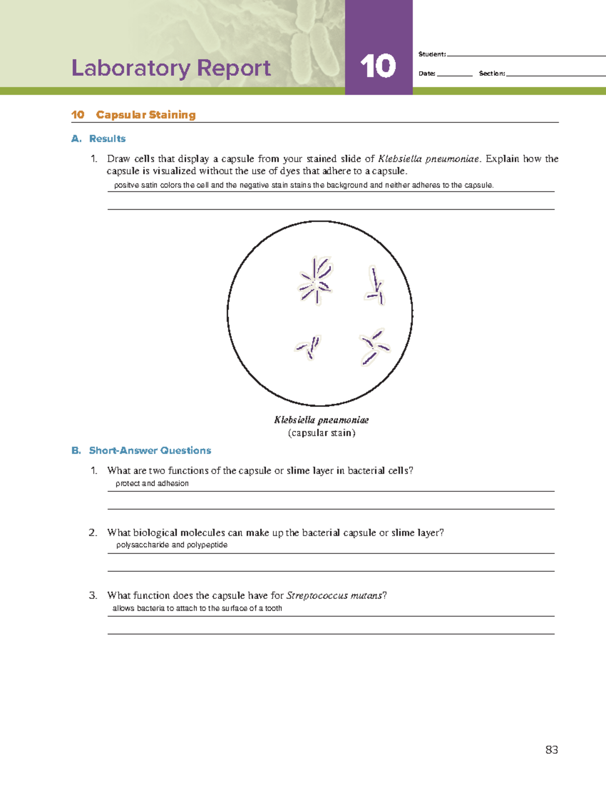 Exercise 10: Capsular Staining Lab Report (GNZ) - Studocu