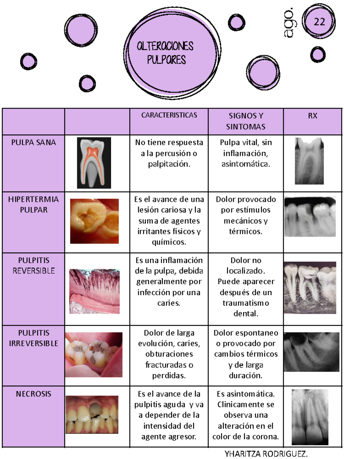 Alteraciones Pulpares: Características, Signos y Sintomas Detallados ...