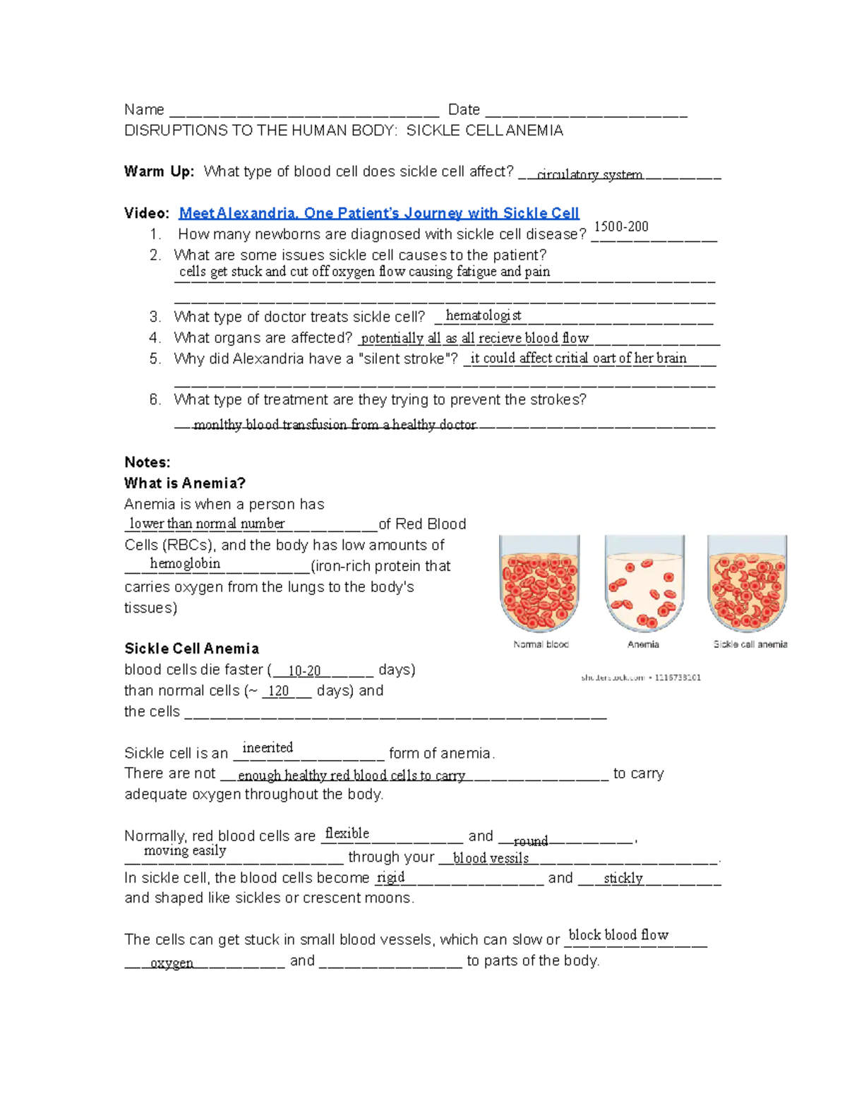 NG Sickle Cell Lesson 21: Understanding Sickle Cell Anemia and ...