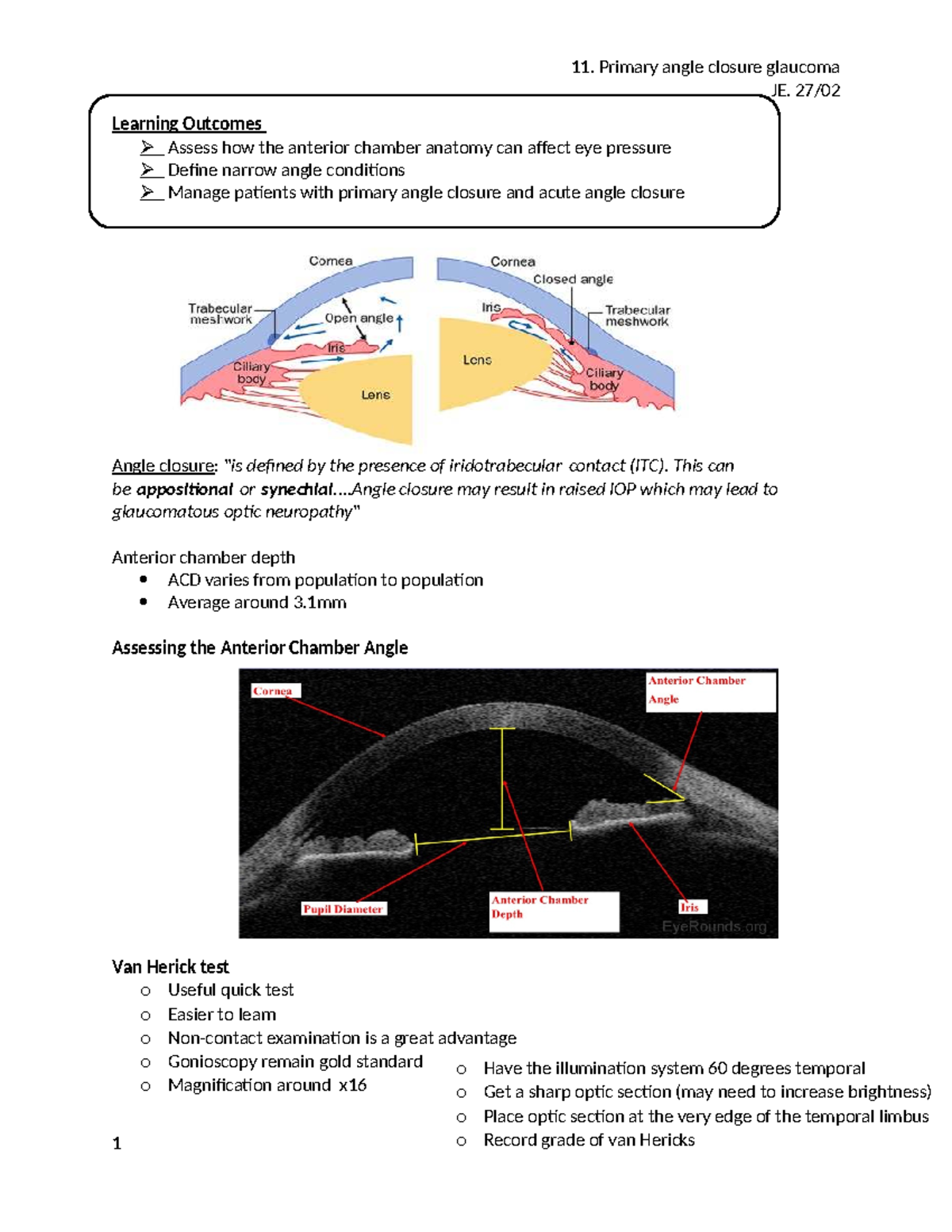11. Primary Angle Closure Glaucoma: Key Concepts and Management - Studocu