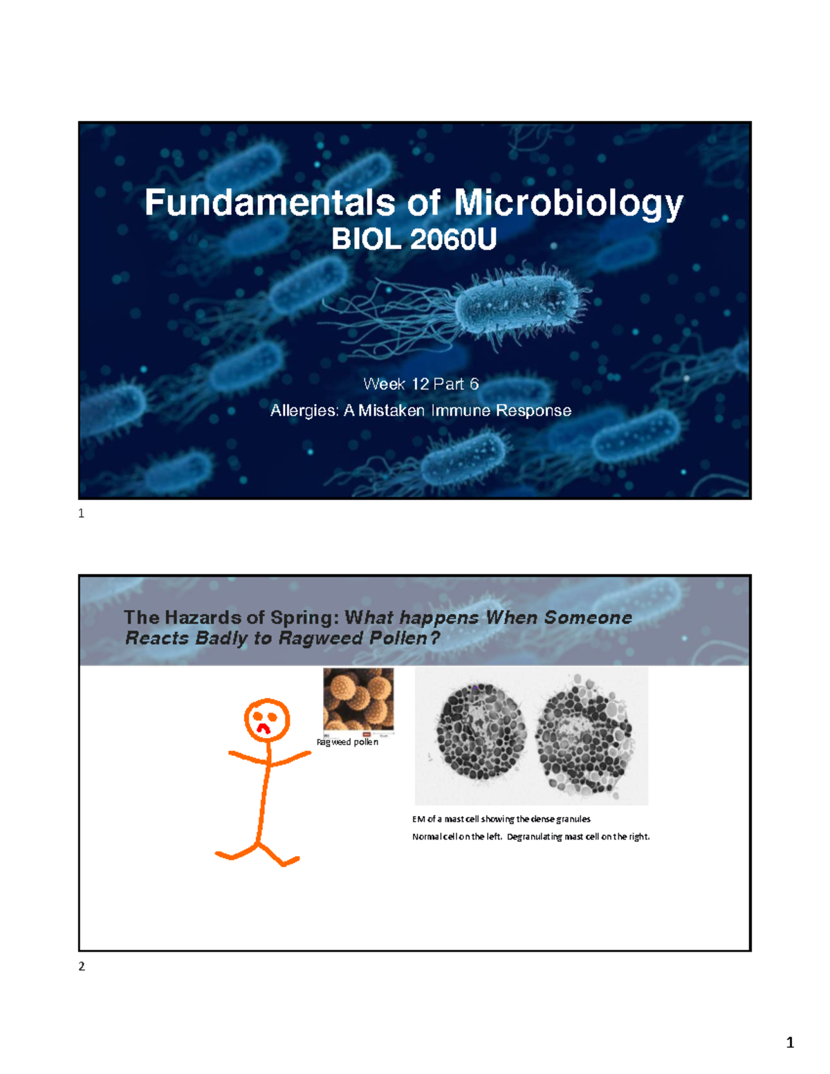 Fundamentals of microbiology BIOL 2060U Week 12 Part 6: Allergies ...