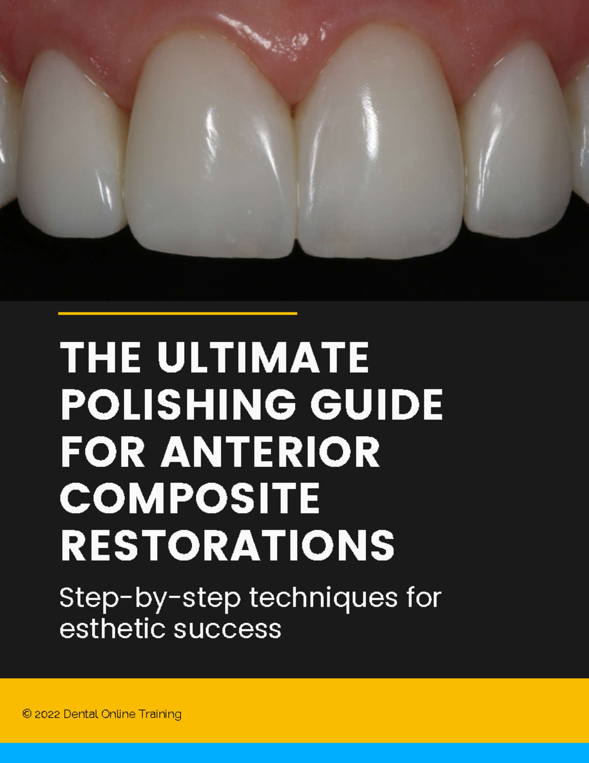 Polishing Guide - DOT - Anterior Composite Restorations Notes - Studocu