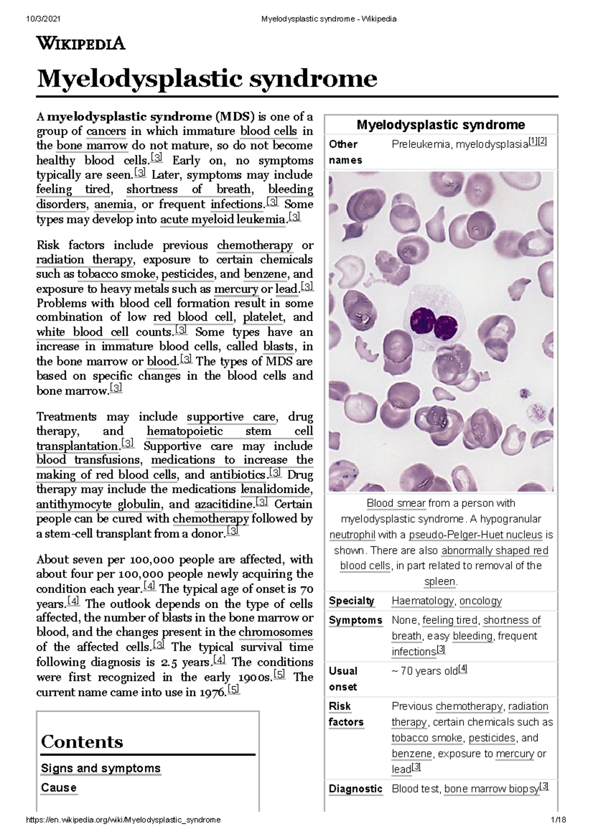 Myelodysplastic Syndrome (MDS): Overview, Symptoms, and Treatments ...