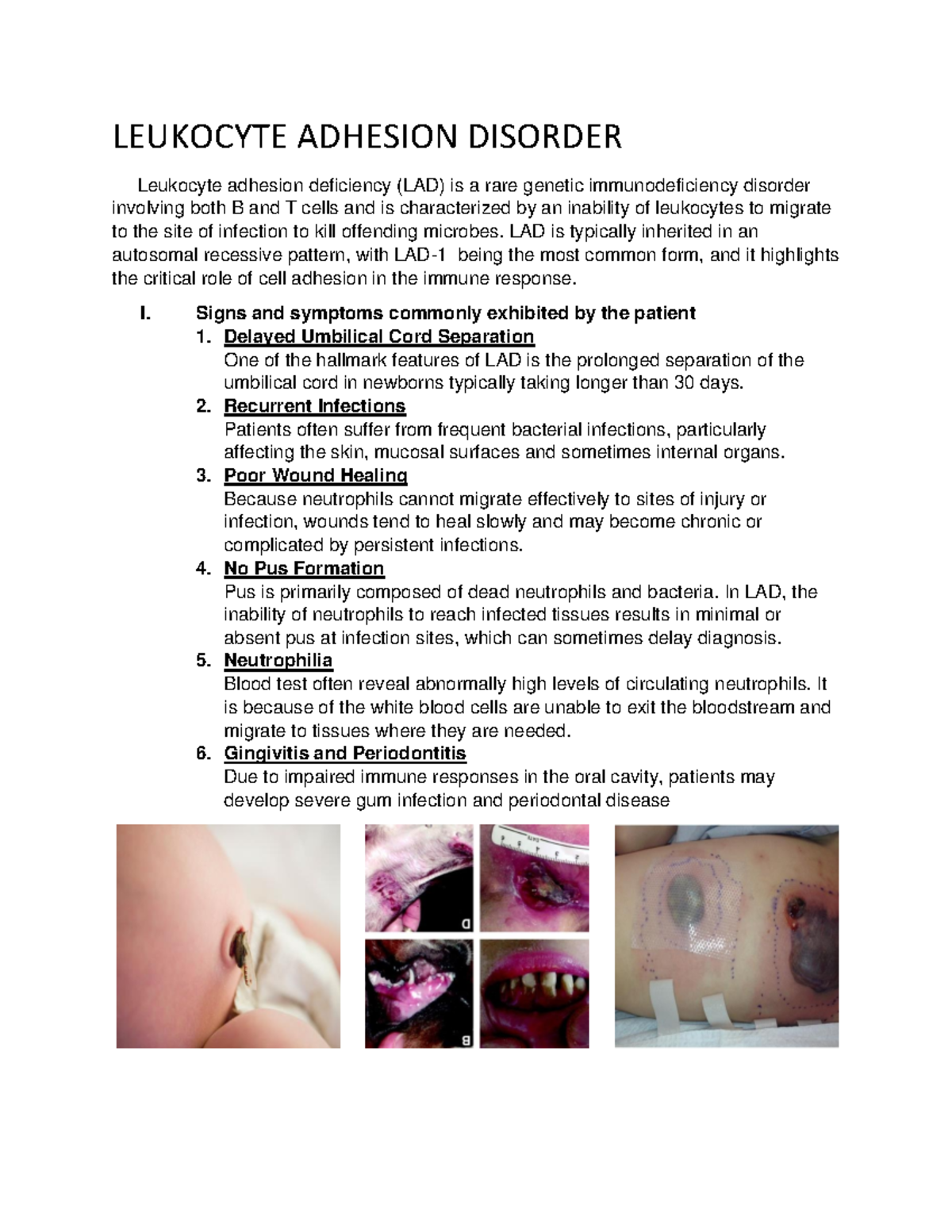 Leukocyte Adhesion Disorder: An Overview of Symptoms, Diagnosis ...
