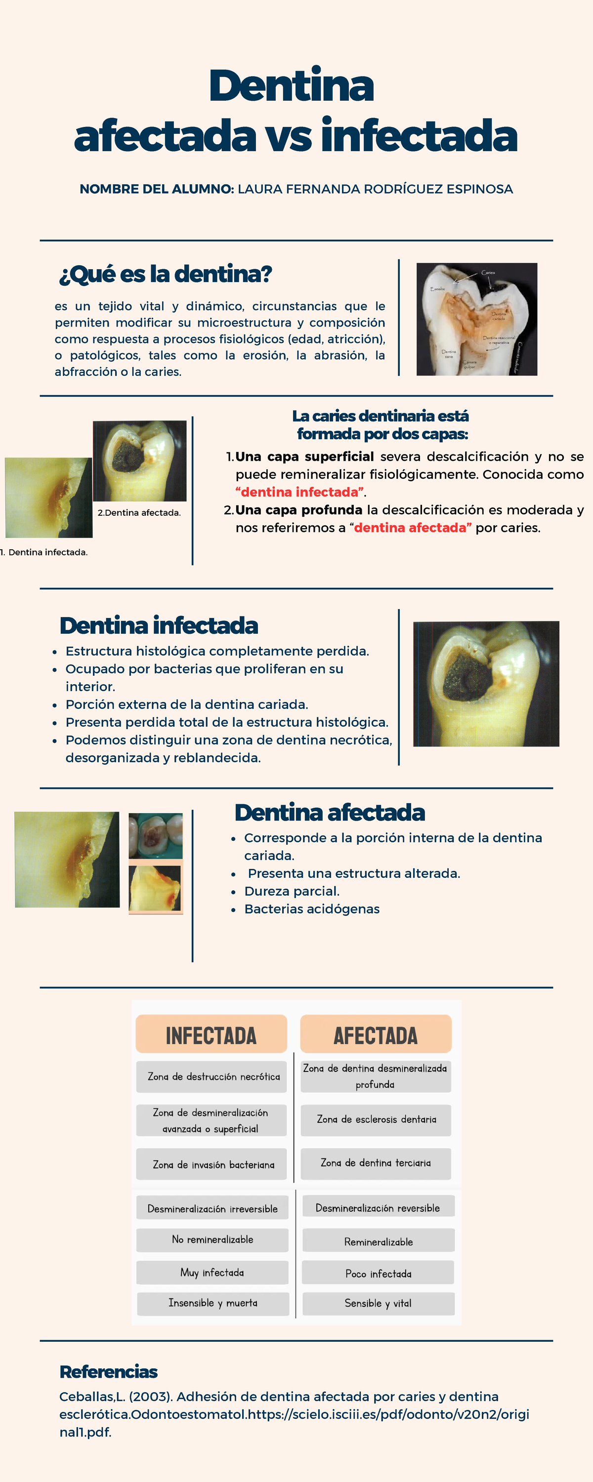 Comparación de Dentina Afectada vs Dentina Infectada - Studocu