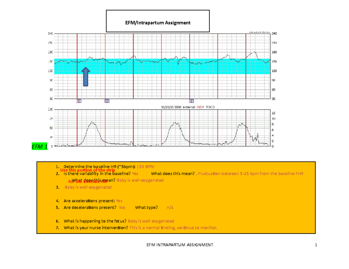 EFM Intrapartum Assignment 1 for OB/GYN Mother-Baby Analysis - Studocu