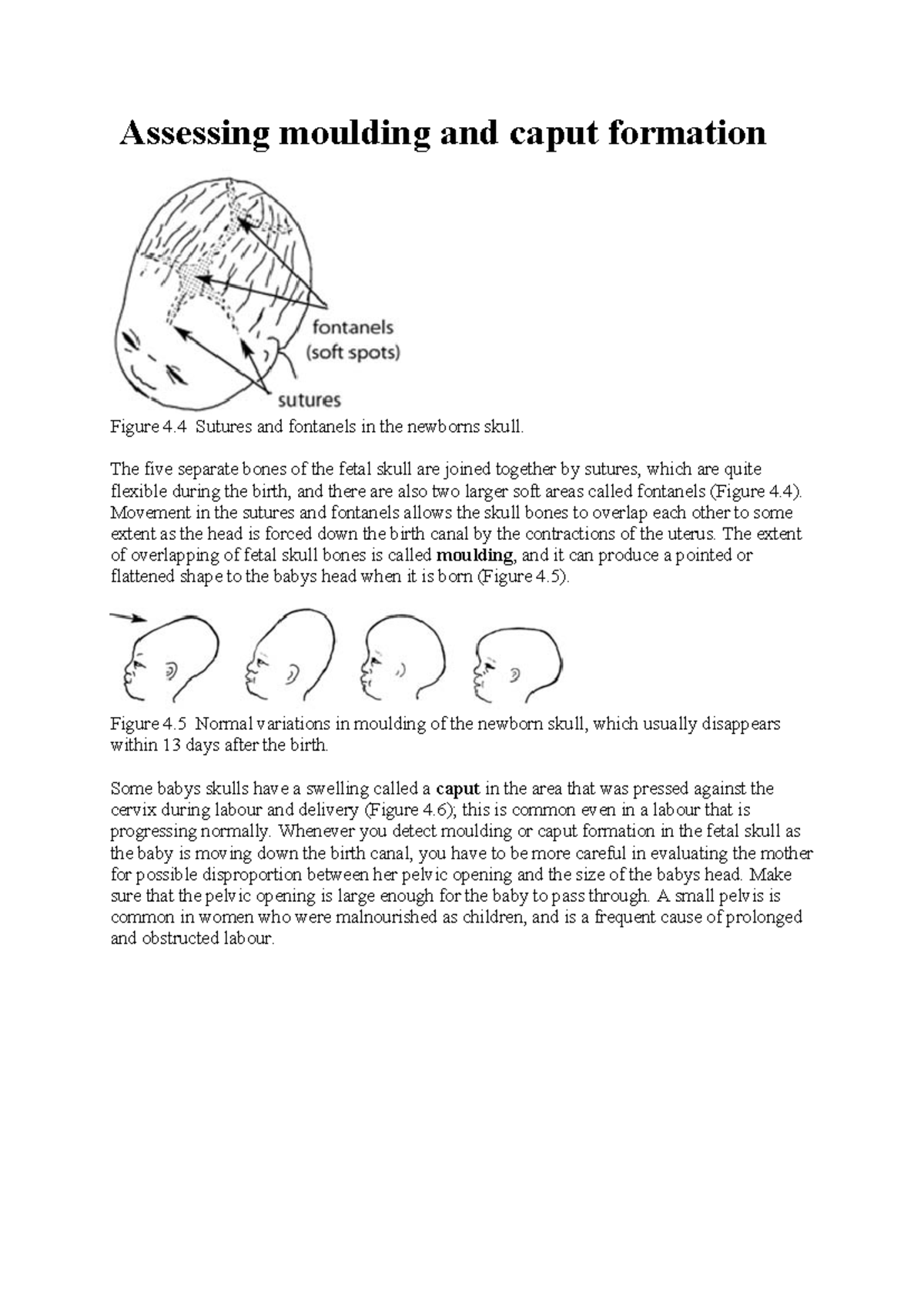 Evaluating Moulding and Caput Formation in Newborns - Module 4.6 - Studocu