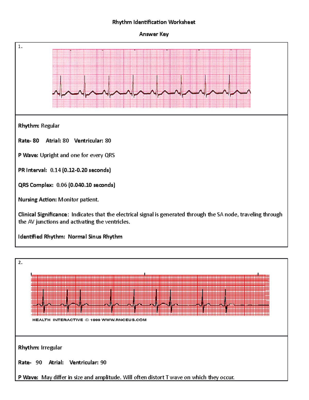 EKG Rhythm Identification Worksheet - Rhythm Identification Worksheet Answer Key 1. Rhythm ...