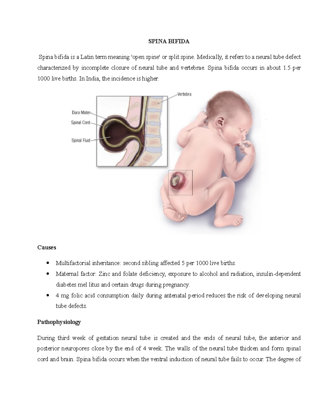 Spina Bifida Overview: Causes, Types, and Nursing Management - Studocu
