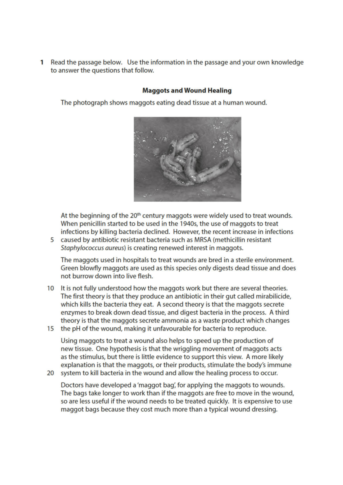 Characteristics of Living Organisms QP2: Antibiotics & Maggot Therapy ...
