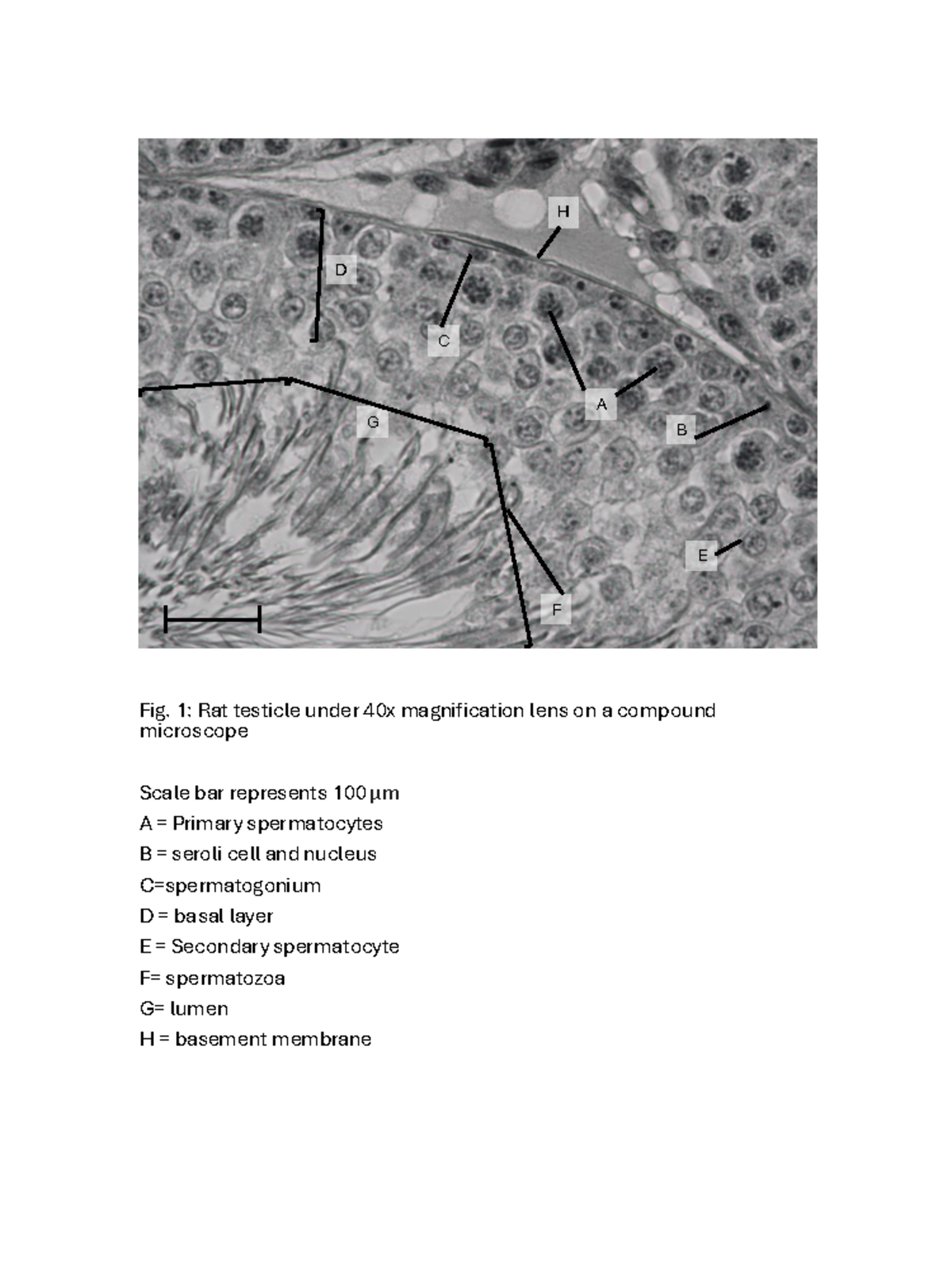 Lab 3: Sperm graph and microscopy analysis of rat testicle - Studocu