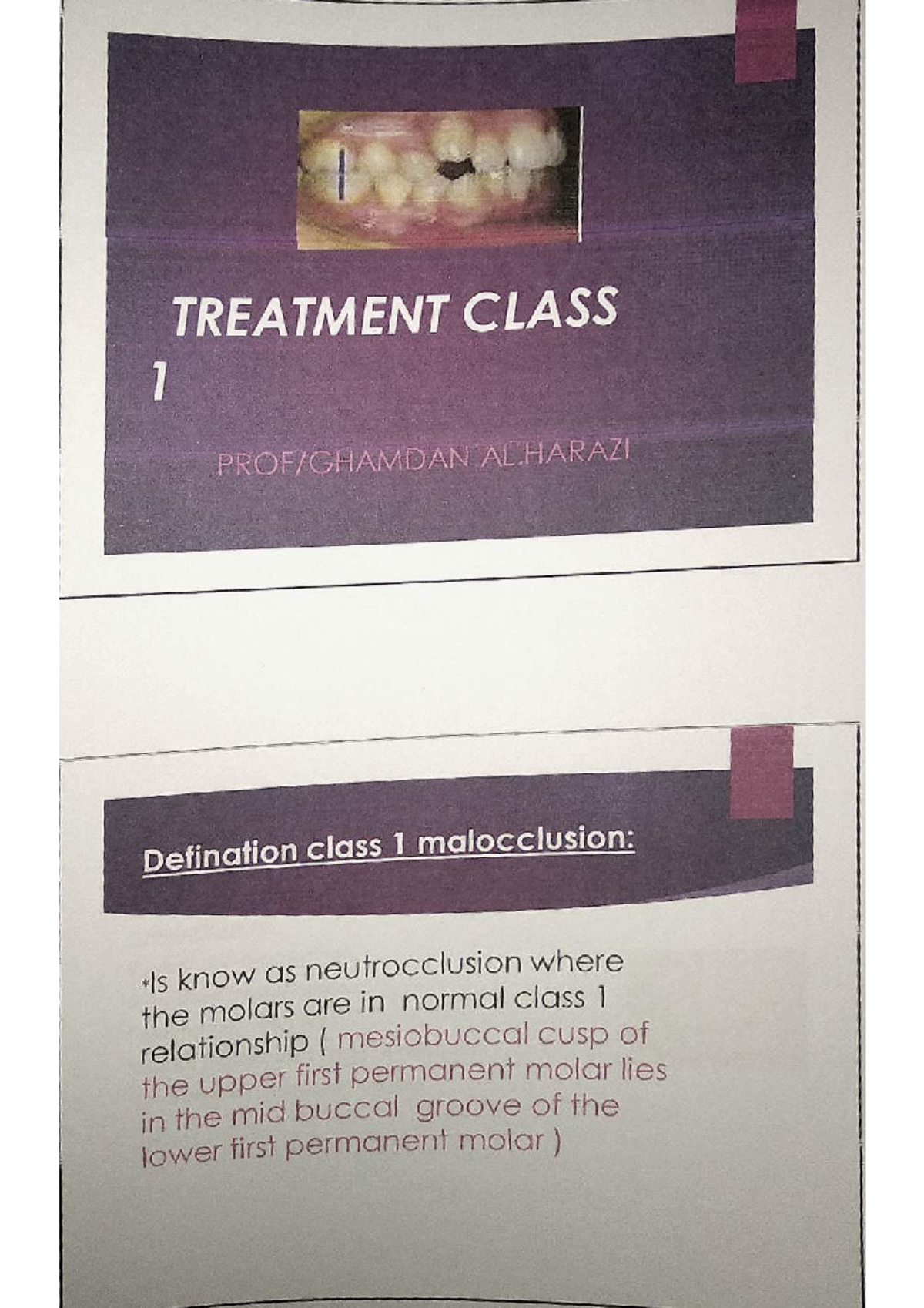 Treatment Class I (1) - Malocclusion Overview and Management - Studocu