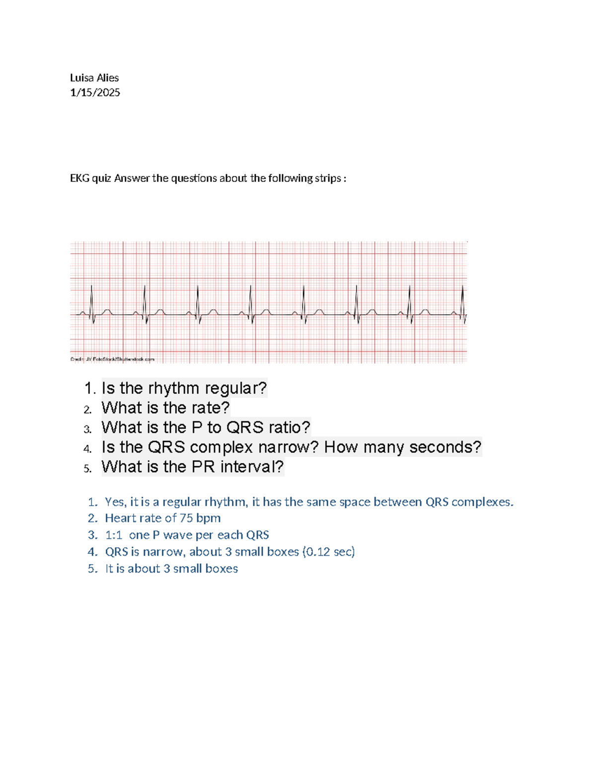 EKG Quiz Strips - EKG Review Exam Questions and Answers - Studocu