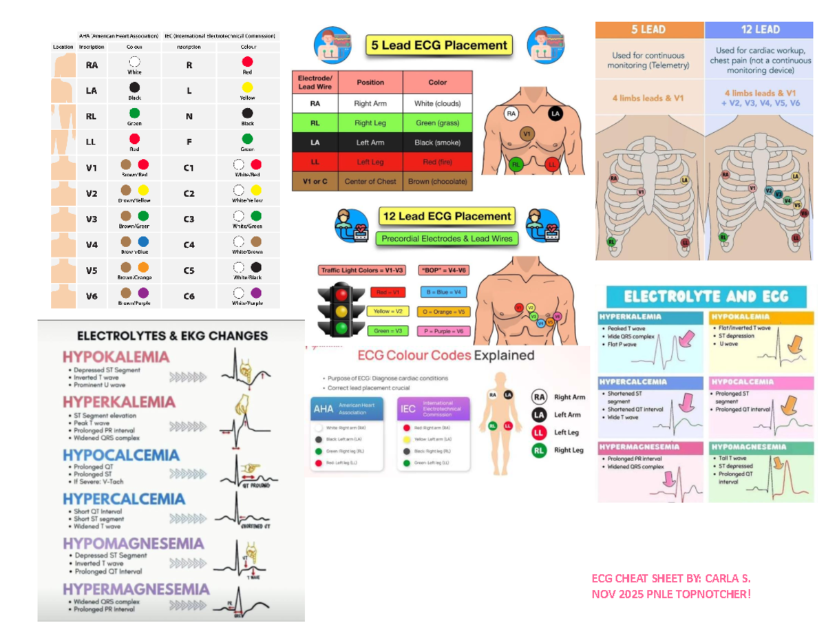 ECG Cheat Sheet: Key Interpretations for PNLE 2025 - Studocu