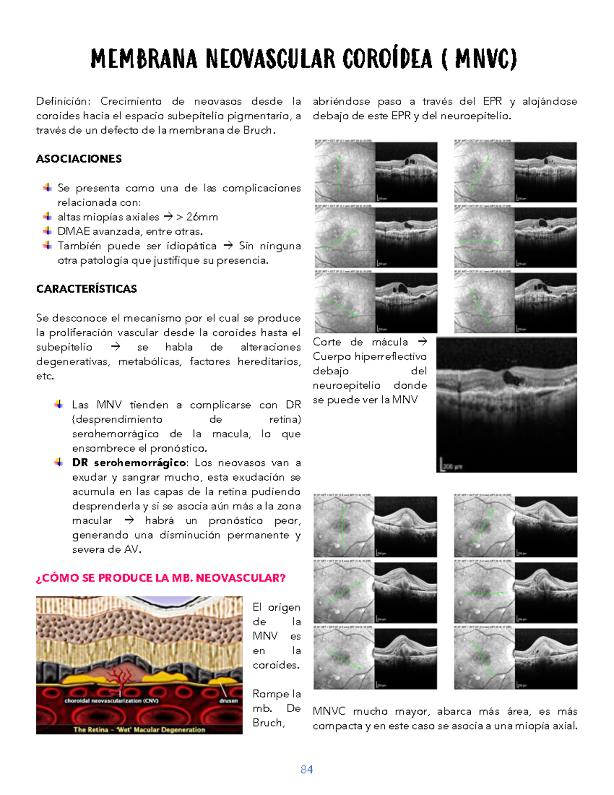 Membrana Neovascular Coroídea (MNVC): Características y Diagnóstico ...