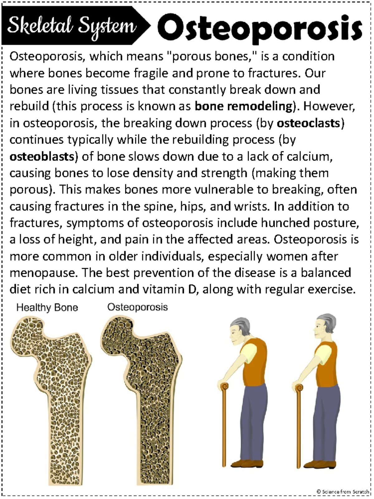 Diseases of the Skeletal System: Overview and Management (BIO 101 ...