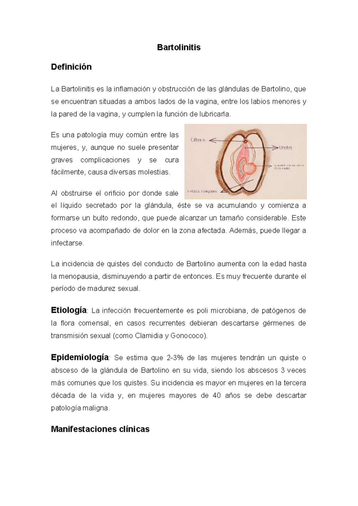 Bartolinitis - DXBN - Bartolinitis Definición La Bartolinitis es la ...