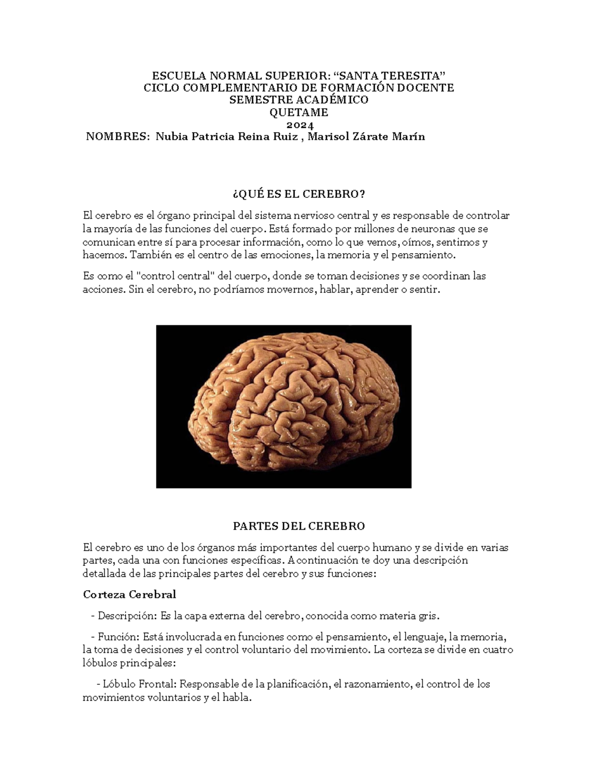 EL Cerebro Y SUS Partes - ESCUELA NORMAL SUPERIOR: “SANTA TERESITA ...