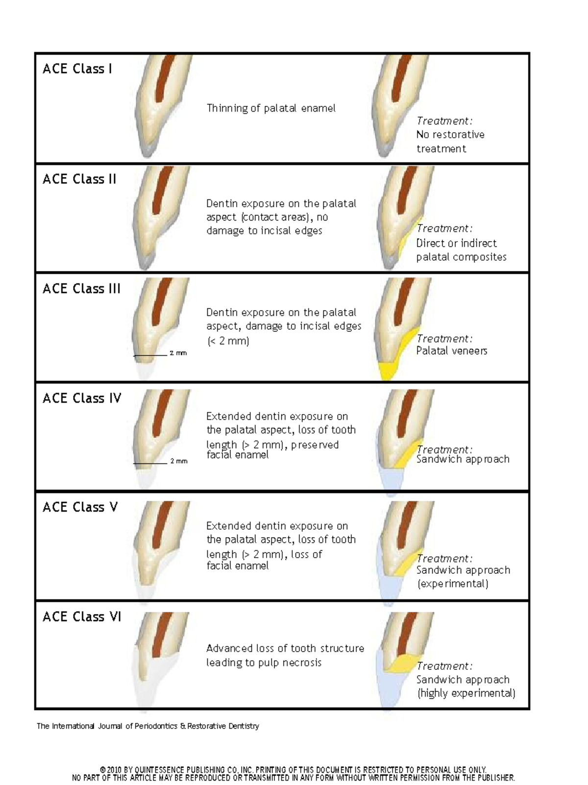 Classification and Treatment of the Anterior Maxillary Dentition ...