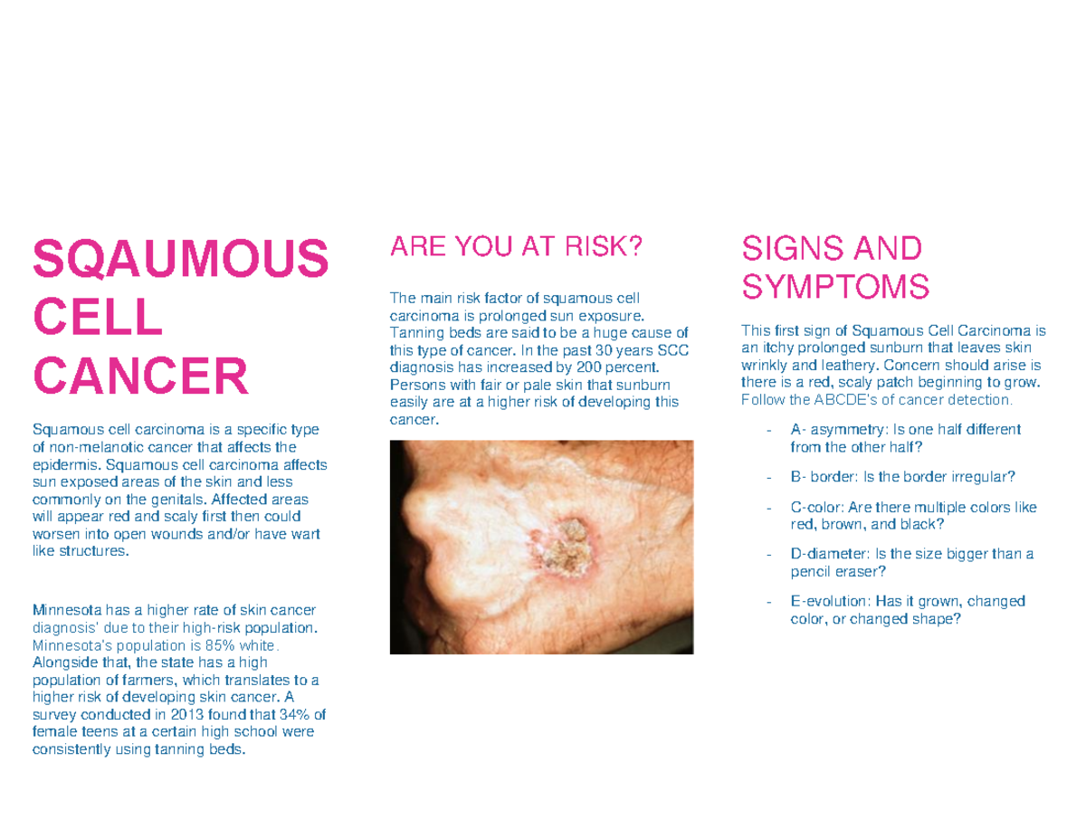 Squamous Cell Cancer Awareness - SCCA Overview and Risks - Studocu