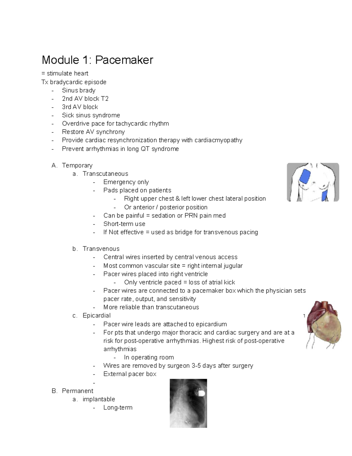 Cardio - Module Notes: Pacemaker & Acute Coronary Syndrome Overview ...