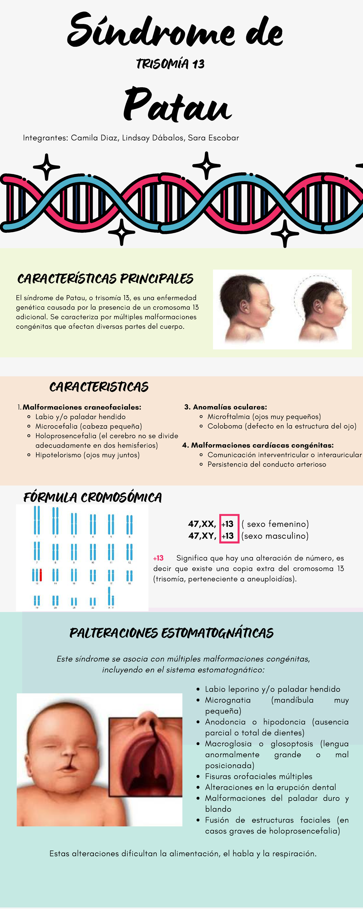 Sindrome de Patau - Síndrome de Patau 3. Anomalías oculares ...