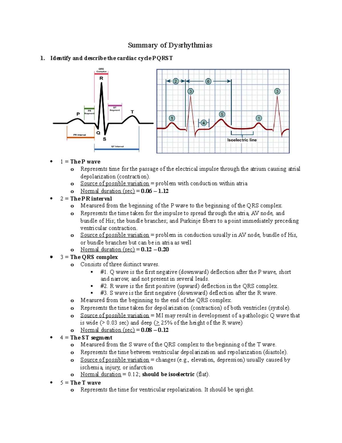 EXAM 4 Study Guide - Chapter 07: Dysrhythmia Interpretation and ...