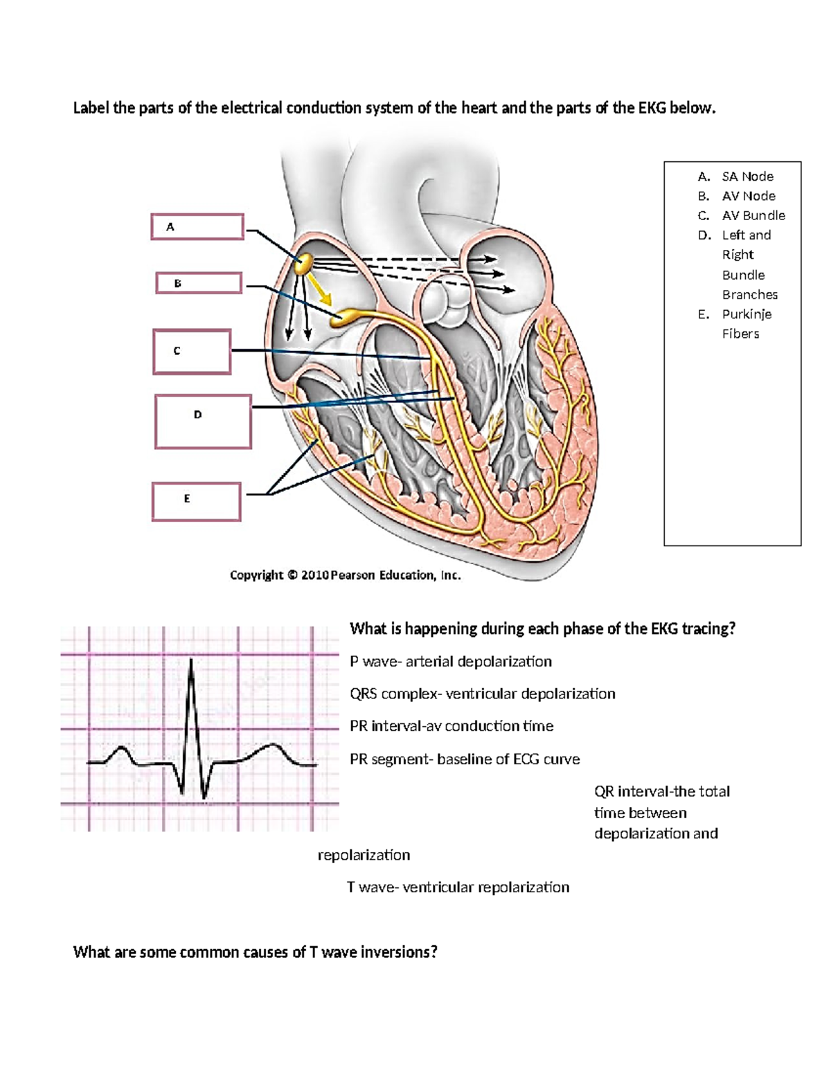 EKG Lab Worksheet Wk 2: Understanding Electrical Conduction & Phases ...