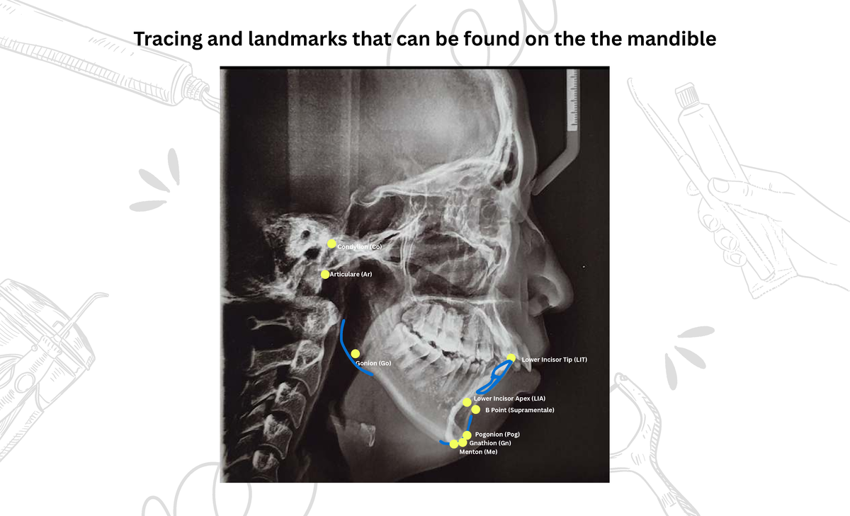 Ortho CEPH Landmark Analysis: Key Points on Mandible & Maxilla - Studocu