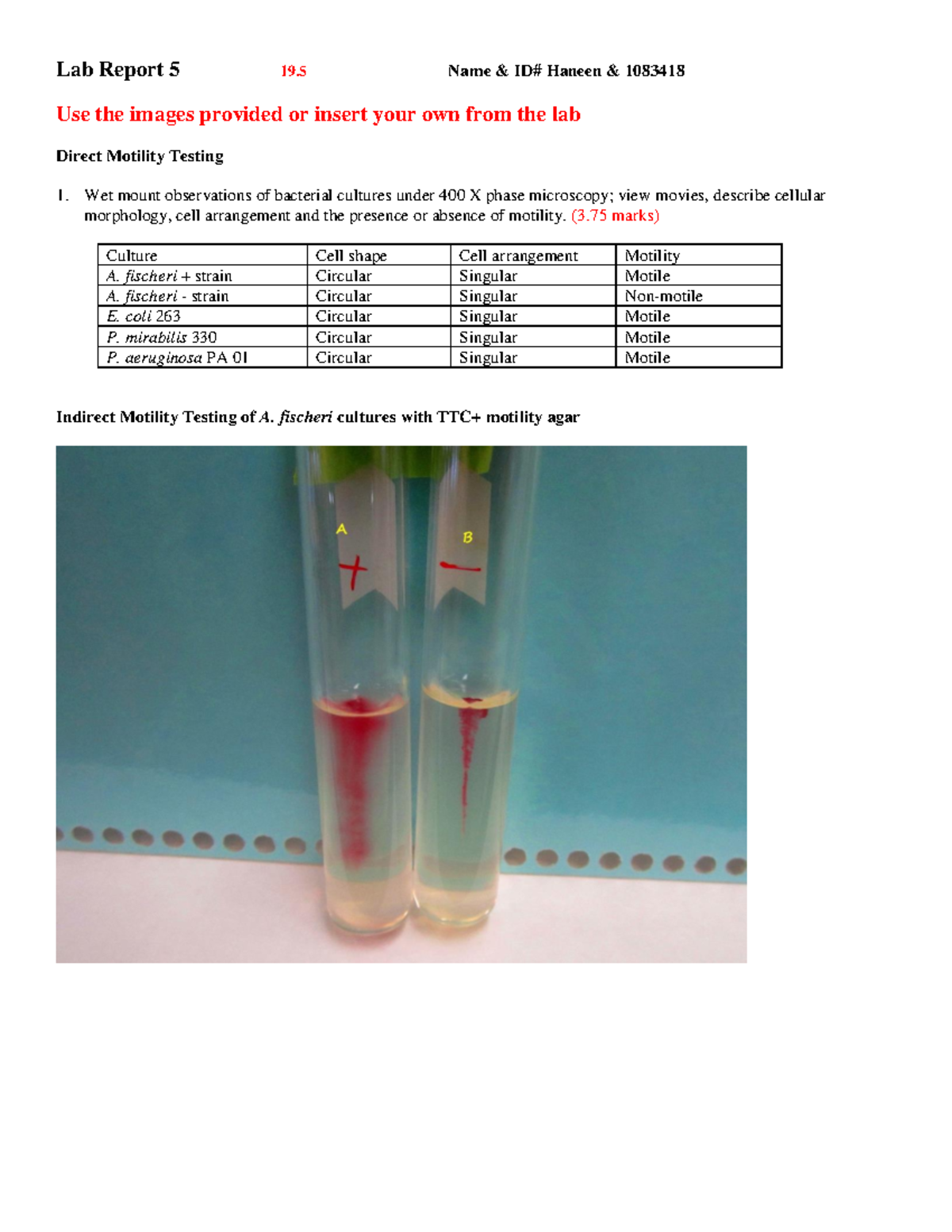 MICR2420 Lab Report 5 F21 - Lab Report 5 19 Name & ID# Haneen & 1083418 ...