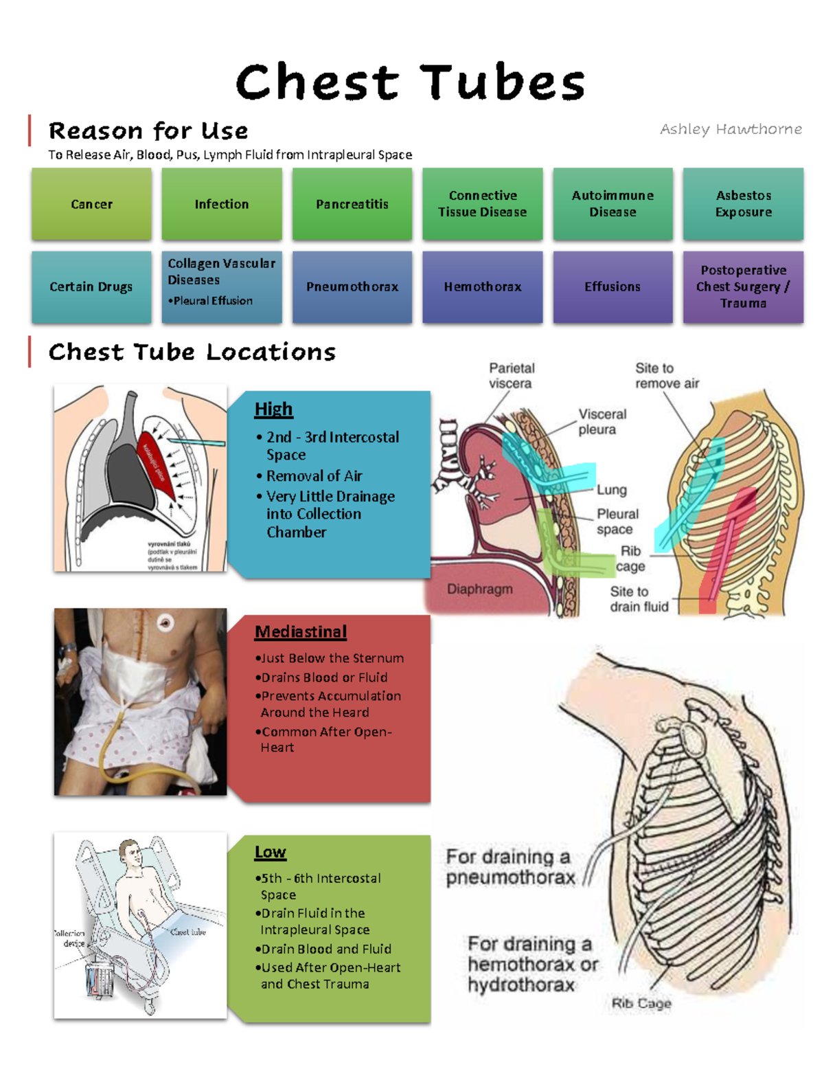 Chest Tubes - Nursing Notes for Intrapleural Drainage Management - Studocu