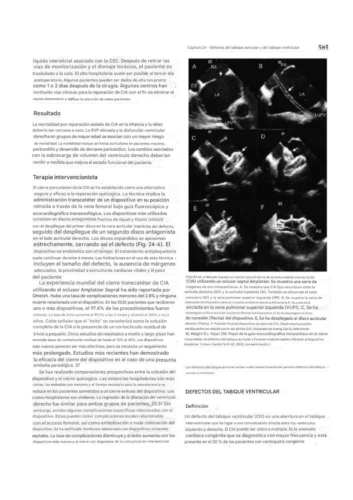 Capítulo 24: Defectos del Tabique Auricular y Ventricular en ...