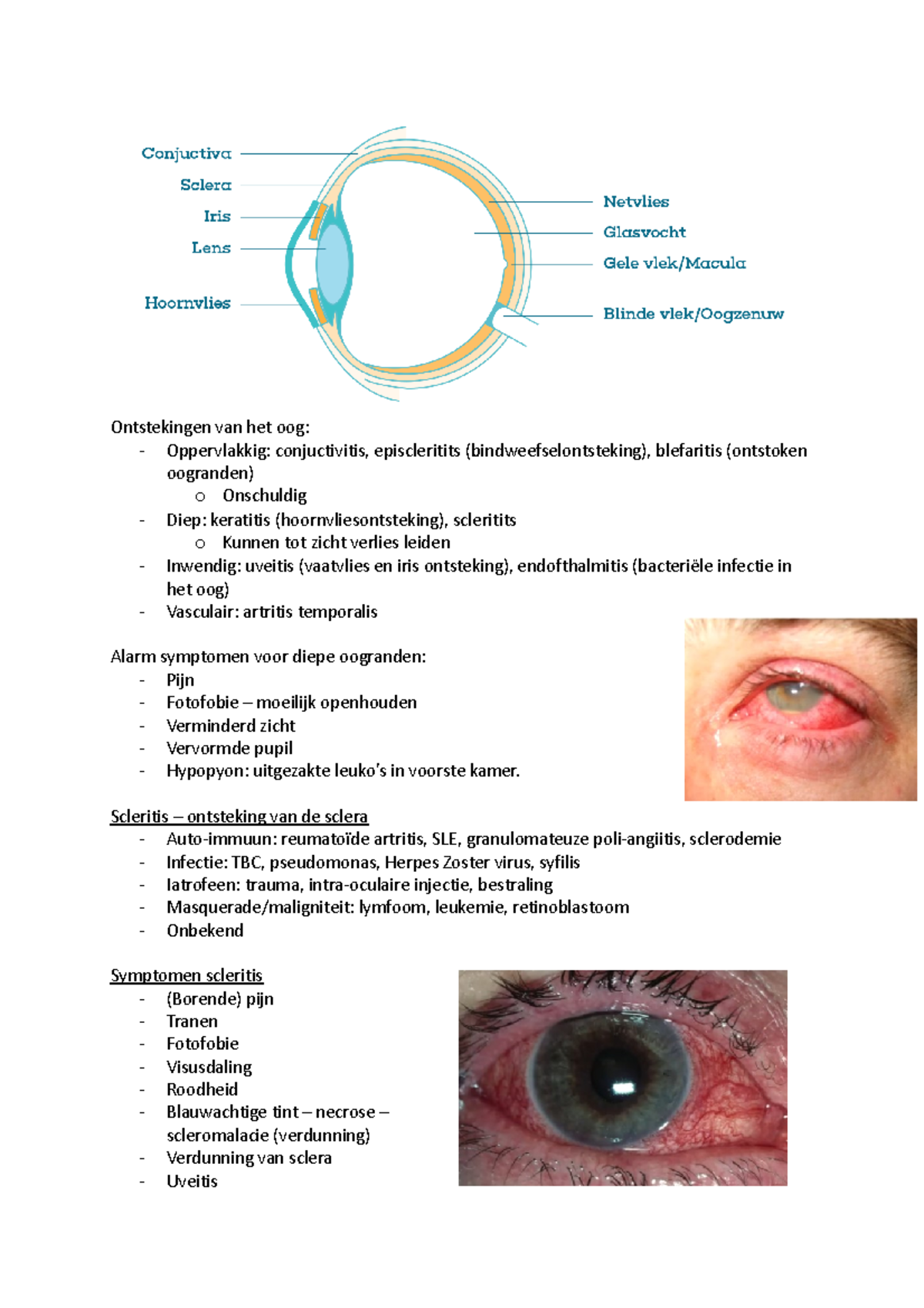 HC 38 Ontstekingen van het Oog: Symptomen en Diagnostiek - Studeersnel
