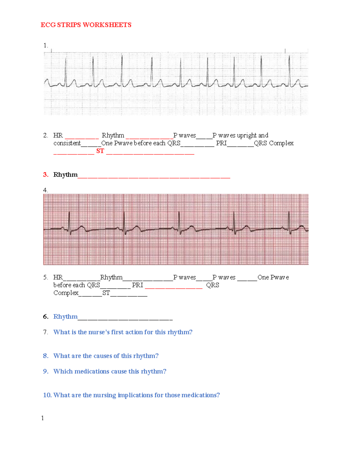 ECG Strips Worksheets: Practice & Dysrhythmia Management - Studocu