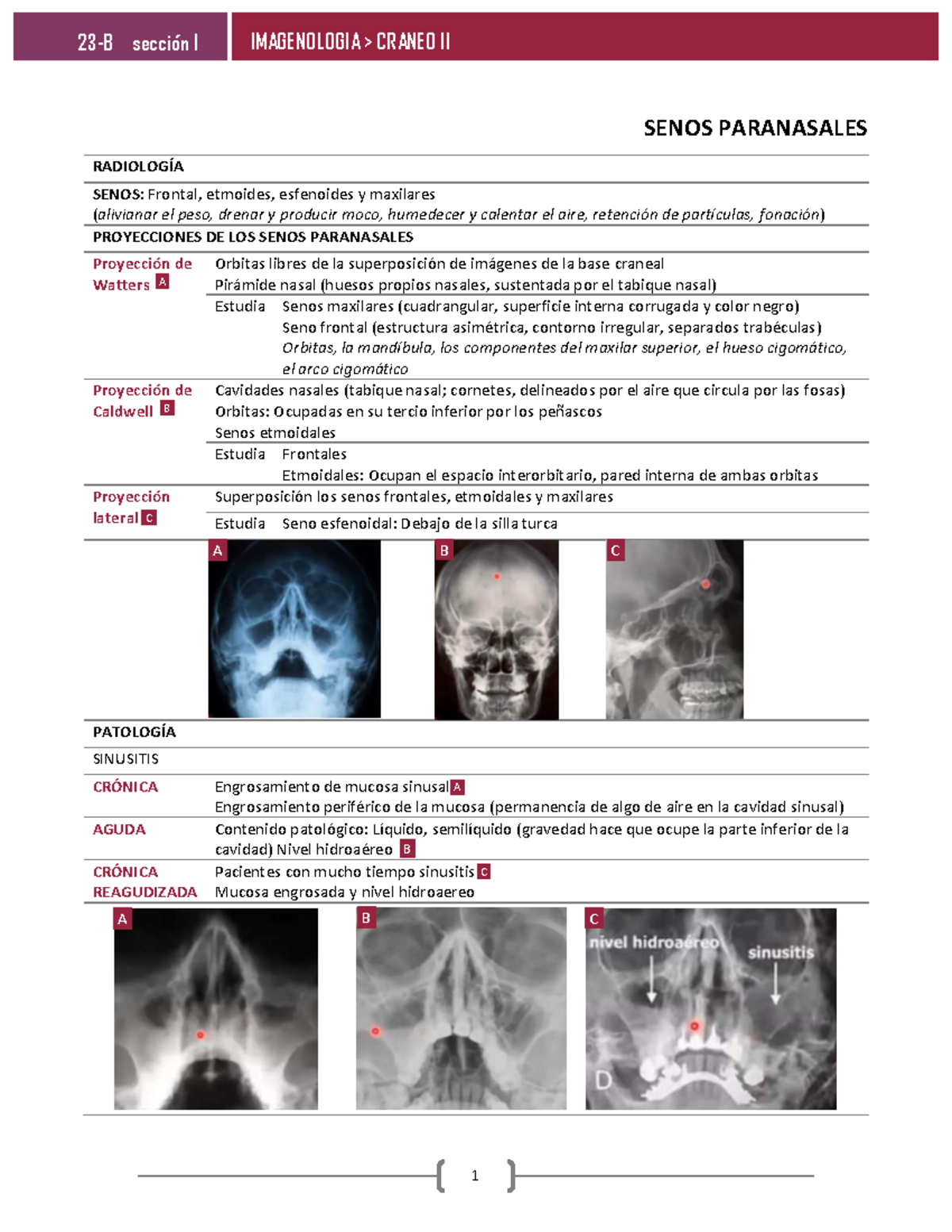 R1-T23B Senos paranasales - 23 - B sección I IMAGENOLOGIA > CRANEO II 1 ...