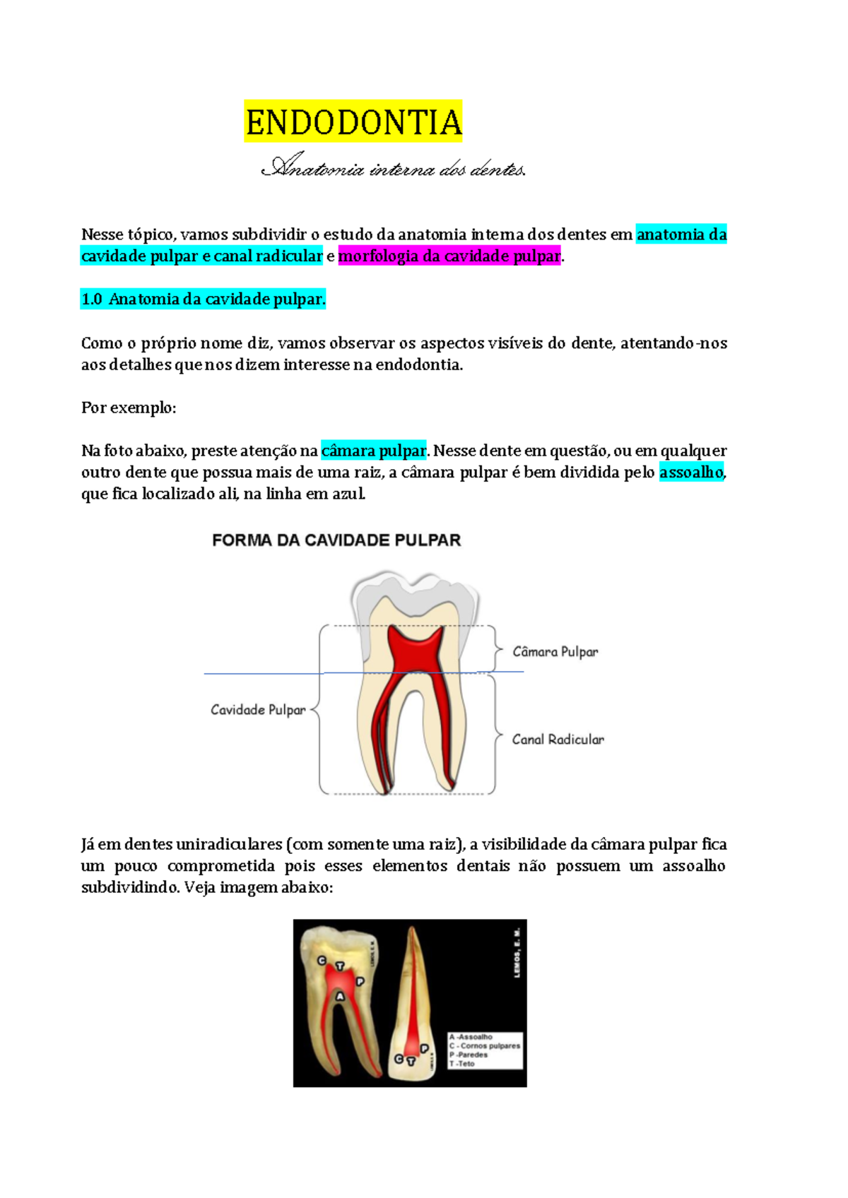 Cavidade Pulpar