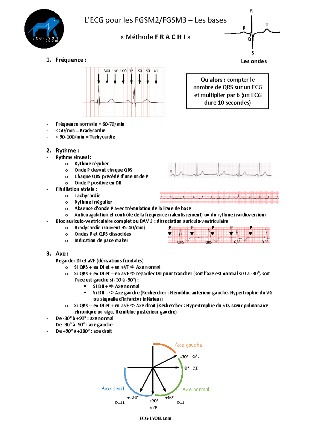 Fiche d'Interprétation ECG pour FGSM2/FGSM3 - Méthode F R A C H I - Studocu