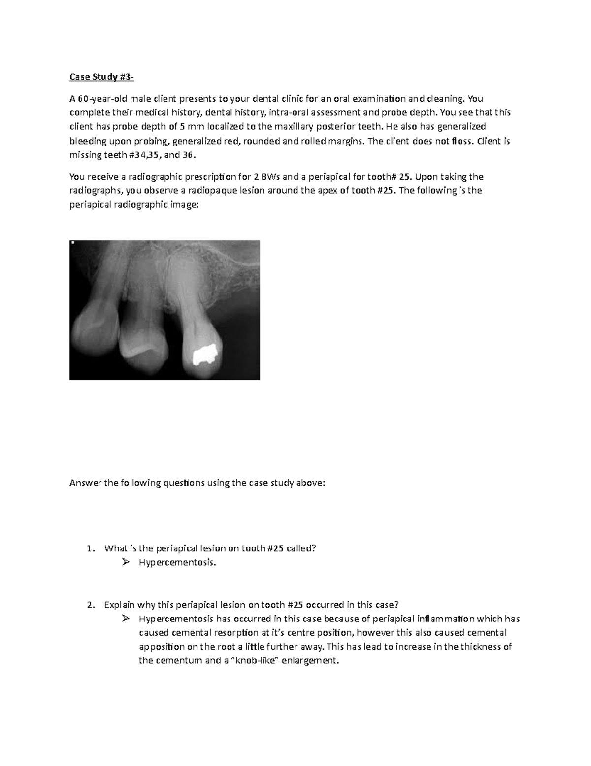 Case Study #3 - Lecture notes - Case Study #3- A 60-year-old male ...