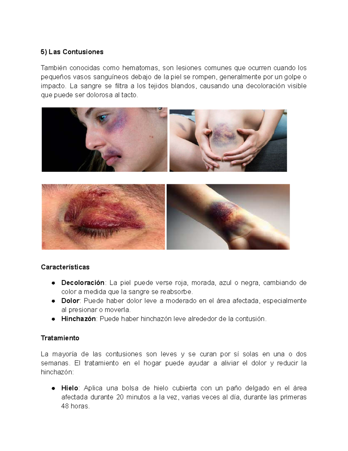 5) Las Contusiones y 6) Heridas contusa - Las Contusiones También ...