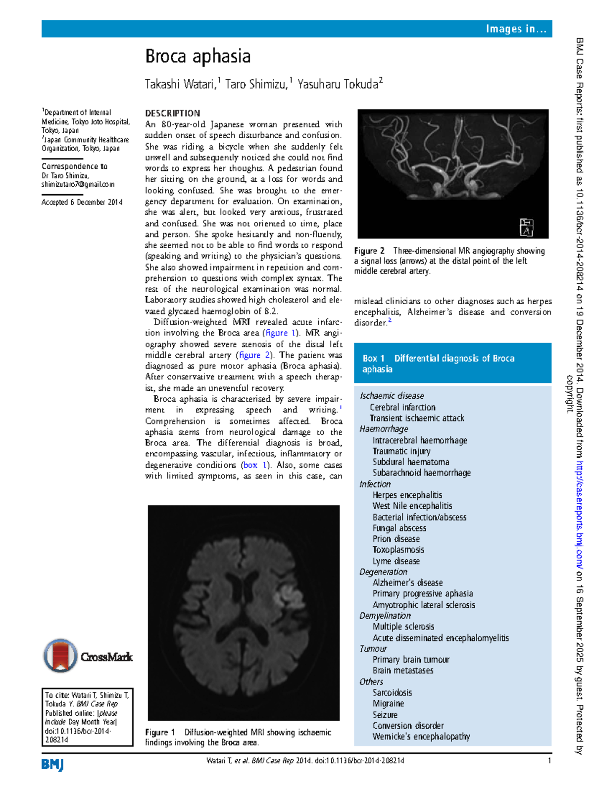 BCR Case Study: Pure Motor Aphasia in a Japanese Woman - Studocu