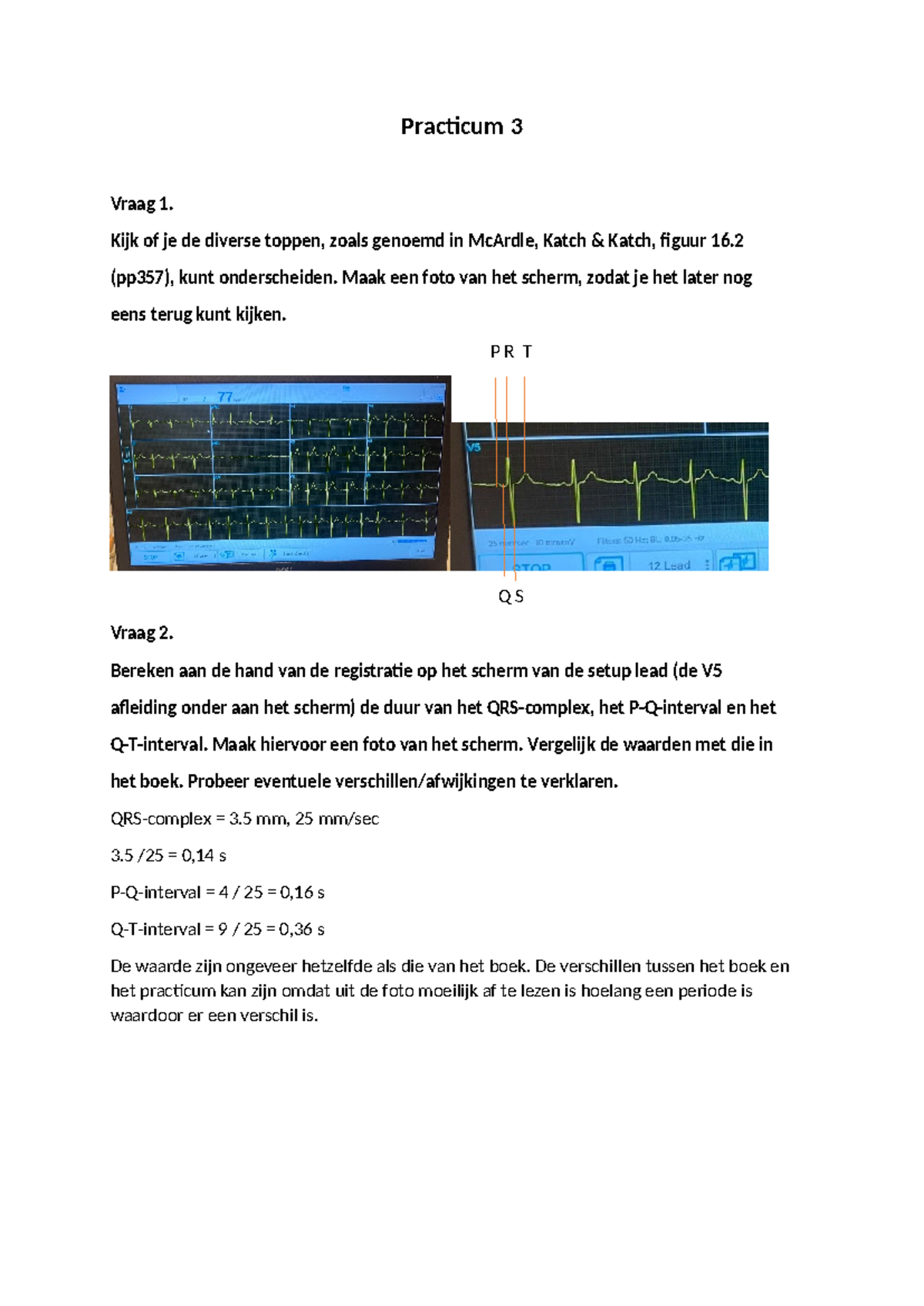 Practicum 3: ECG Analyse en Hartfrequentie Berekeningen - Studeersnel
