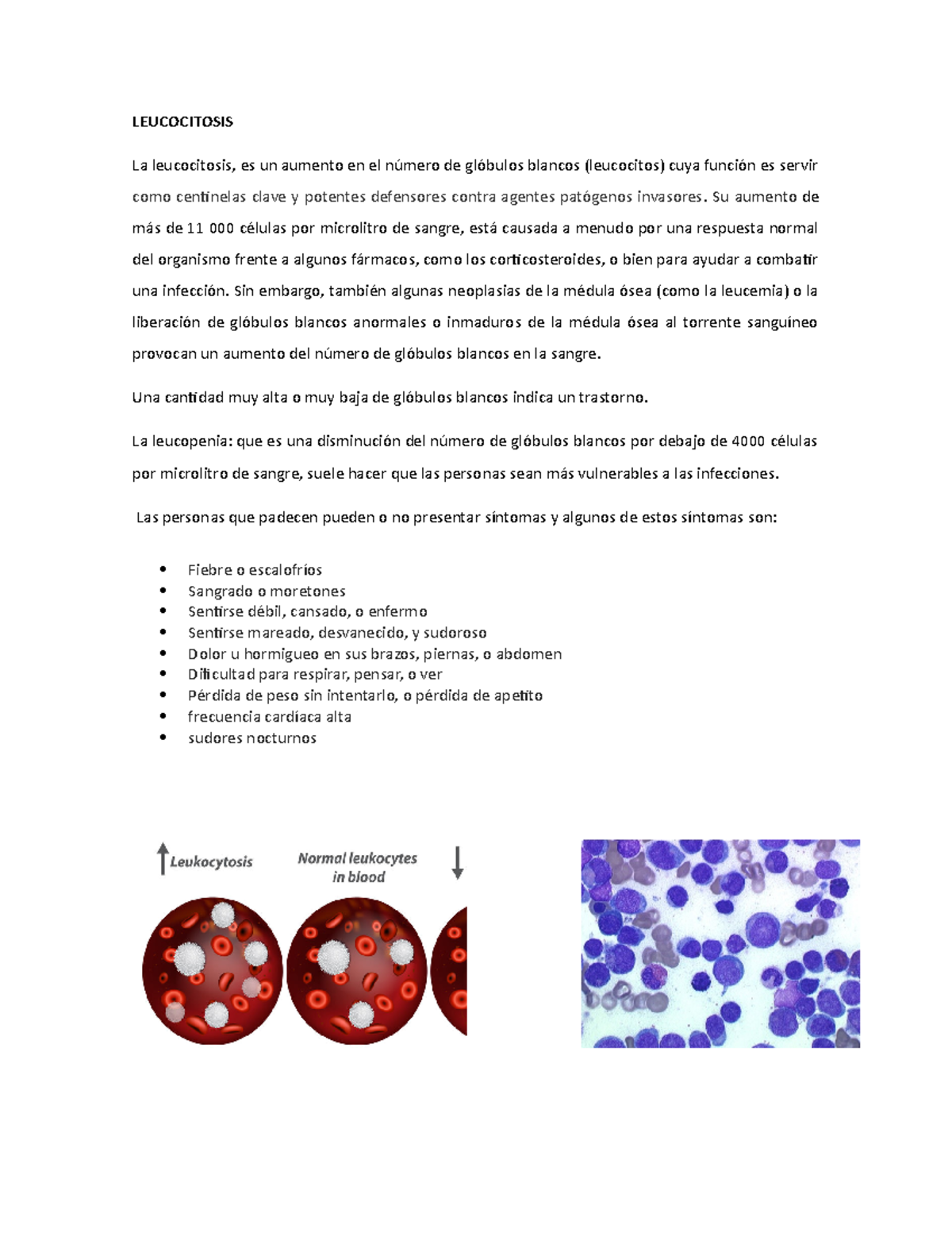 Leucocitosis EFE - lkjh - LEUCOCITOSIS La leucocitosis, es un aumento ...