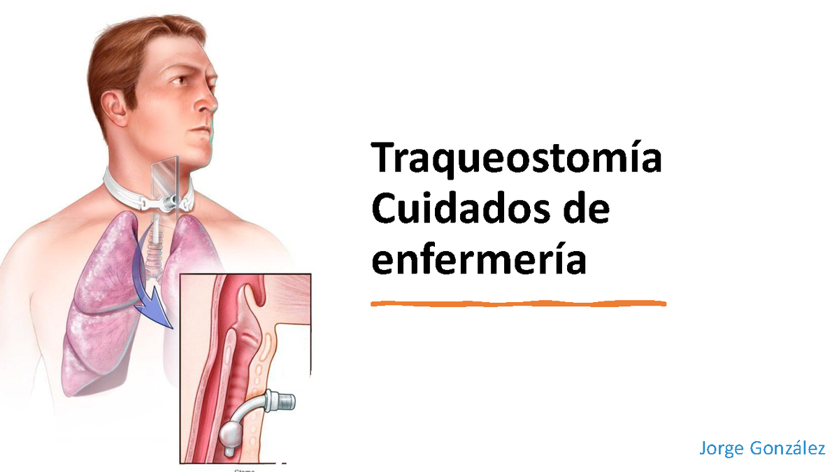 Cuidados De La Traqueotomía