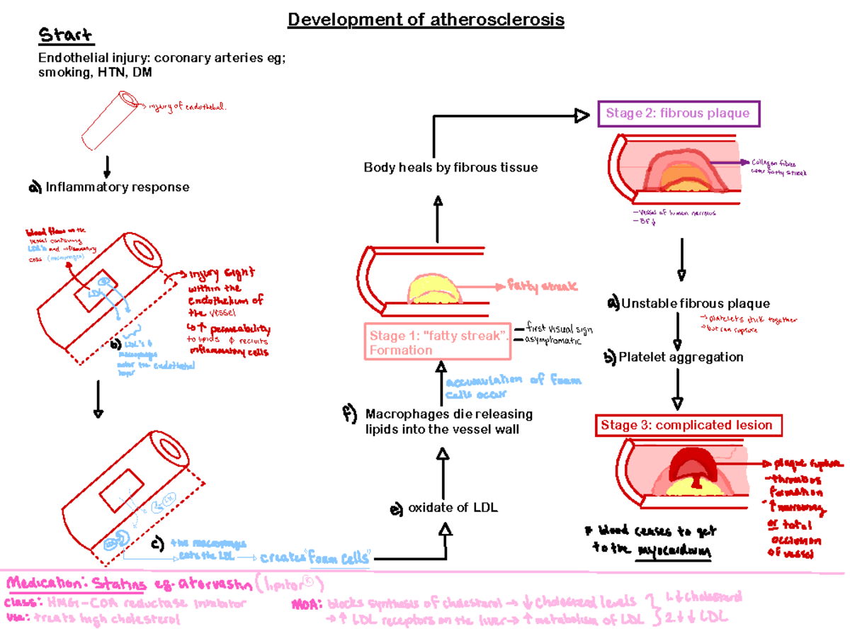 Week 1 - Atherosclerosis Pathophysiology Overview and Key Stages - Studocu