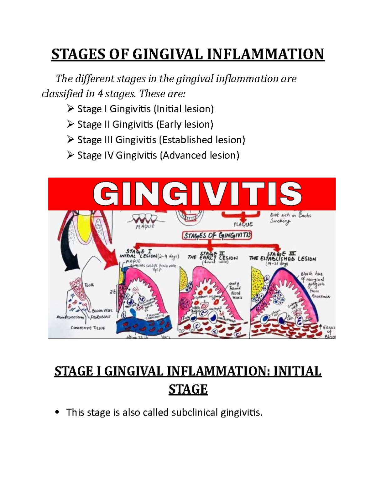 Stages OF Gingival Inflammation - STAGES OF GINGIVAL INFLAMMATION The different stages in the ...