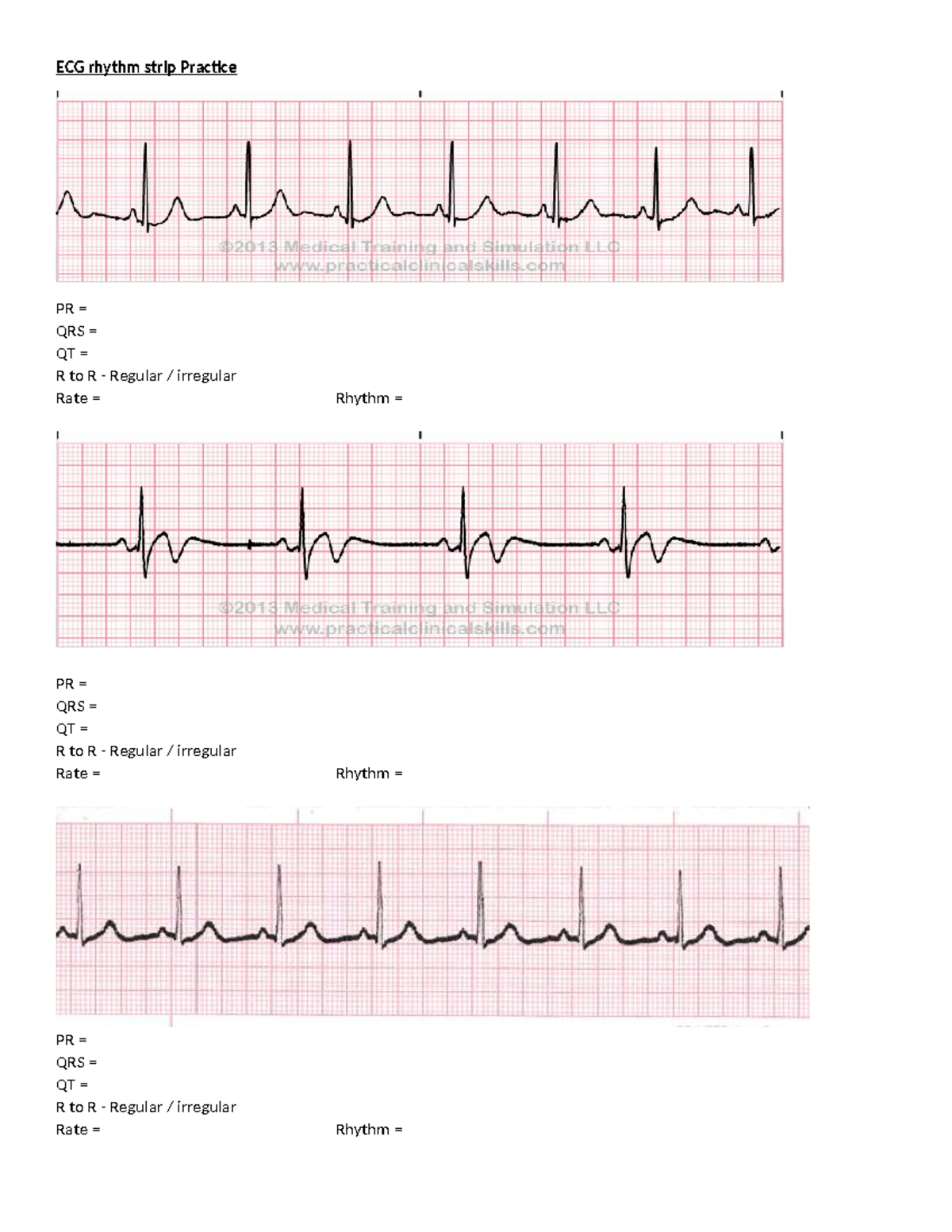 ECG Rhythm Strip Interpretation: PR, QRS, QT Analysis - Studocu