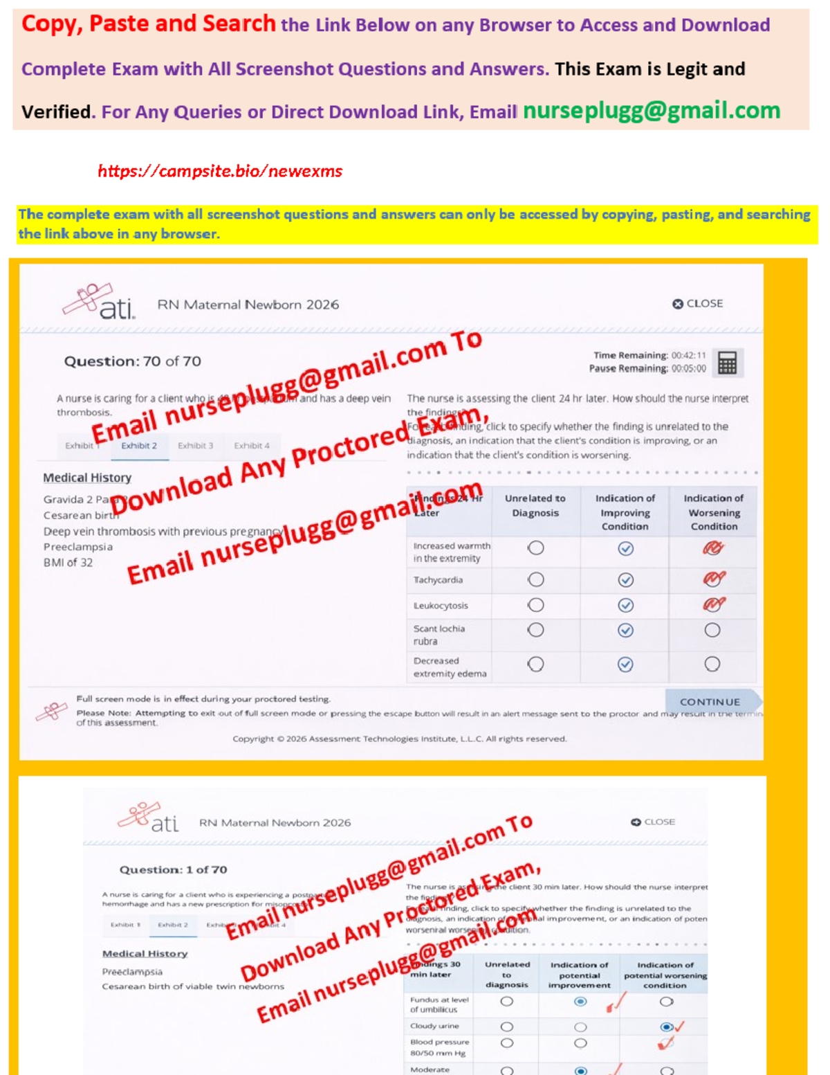 First Attempt ATI RN Maternal Newborn 2026 Proctored Exam with NGN 70 ...