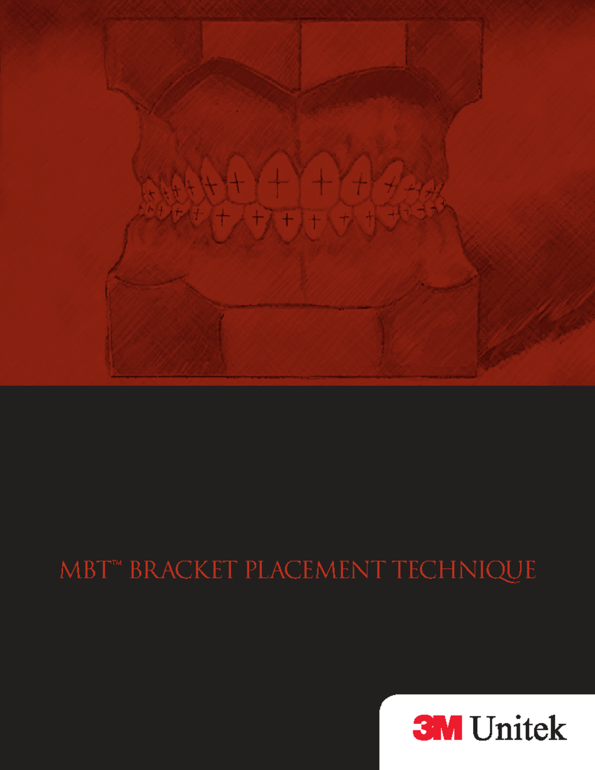 MBT Bracket Placement Technique: A Comprehensive Guide - Studocu